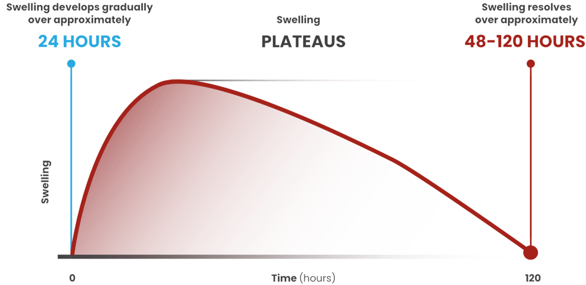 HAE Overview | For People with HAE | deflate HAE
